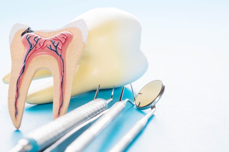 What Are Endodontics And When Do You Need Them? | Team Dental